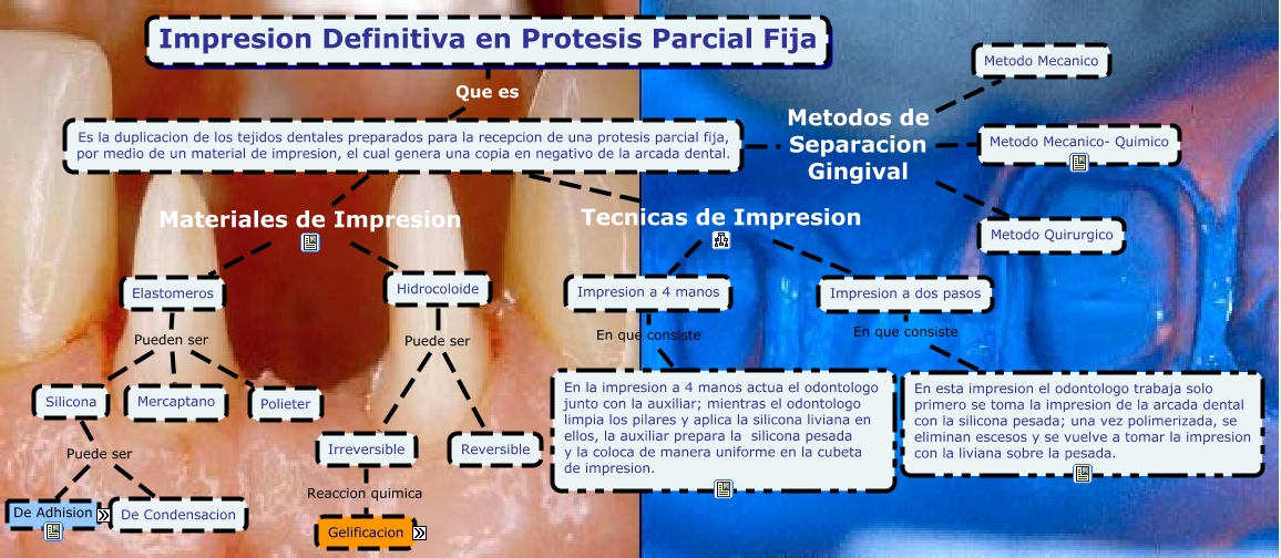 Impresion Definitiva Protesis Fija