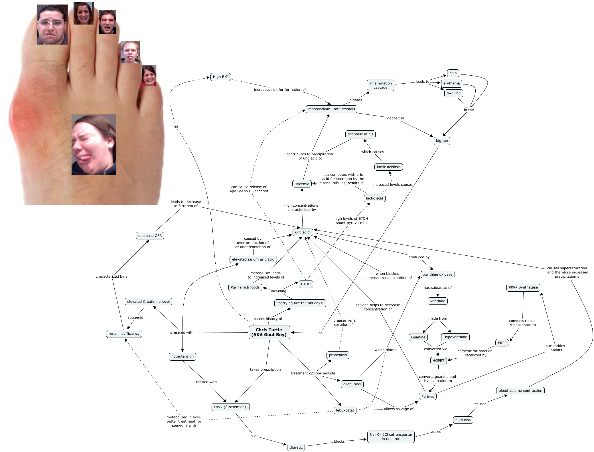 The Gout