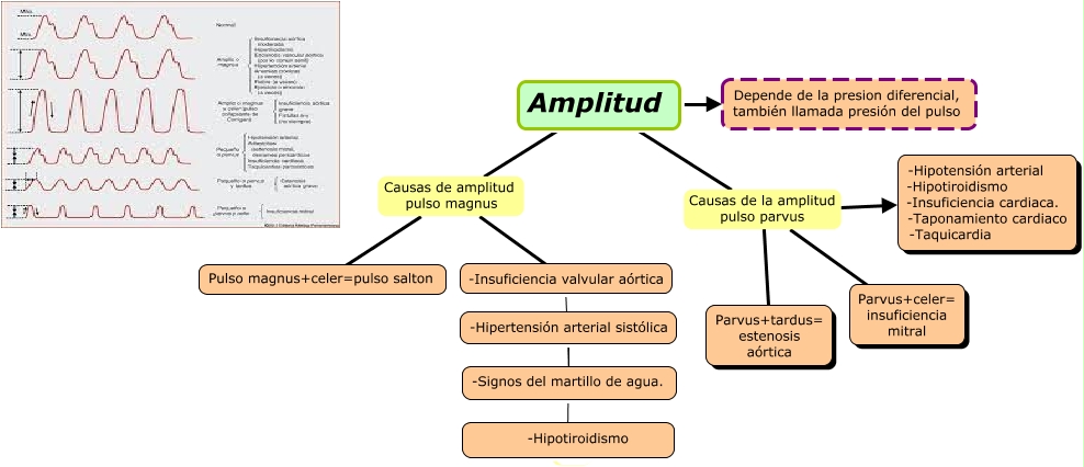 Amplitud