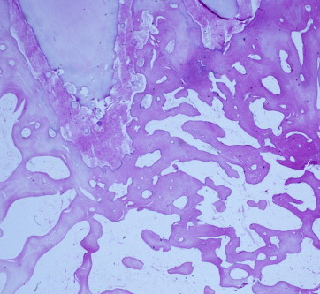 Copia de patologia periapical cmap 2